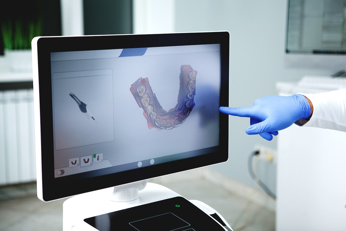 Invisalign 101 - Most Common Questions Answered | Inverurie Smile Care
